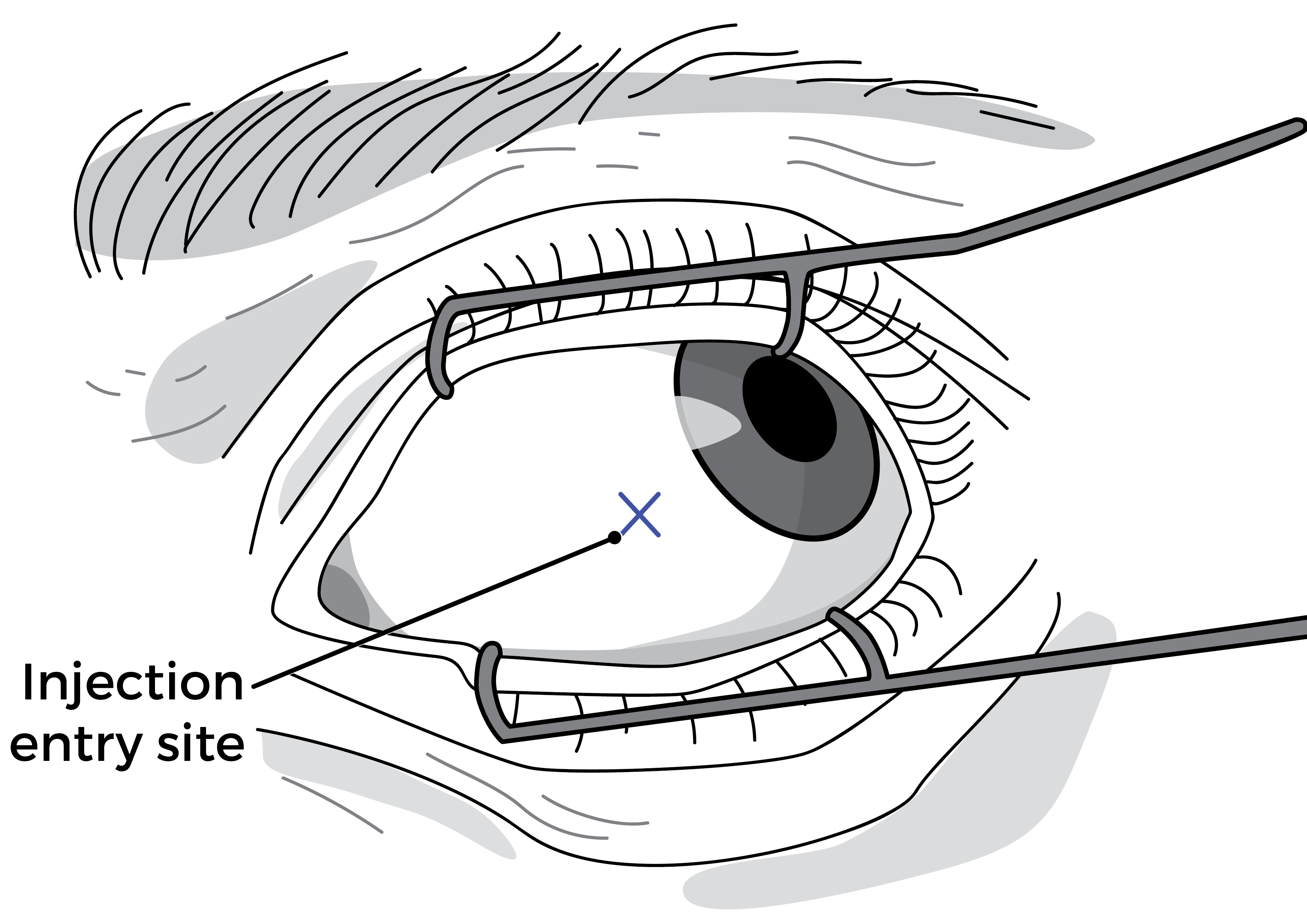 eye_vector_3-01 | Professor Adnan Tufail, MBBS, MD, FRCOphth