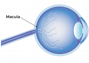 Laser treatment for the peripheral retina (PRP) | Professor Adnan ...